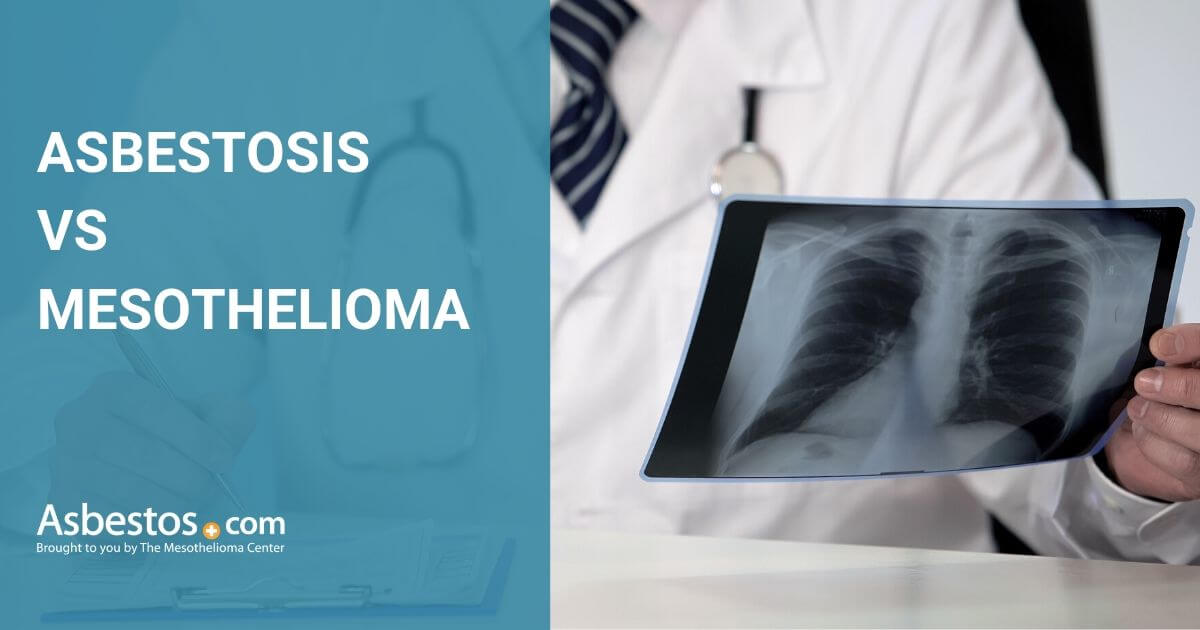 Asbestosis Vs Mesothelioma Key Differences