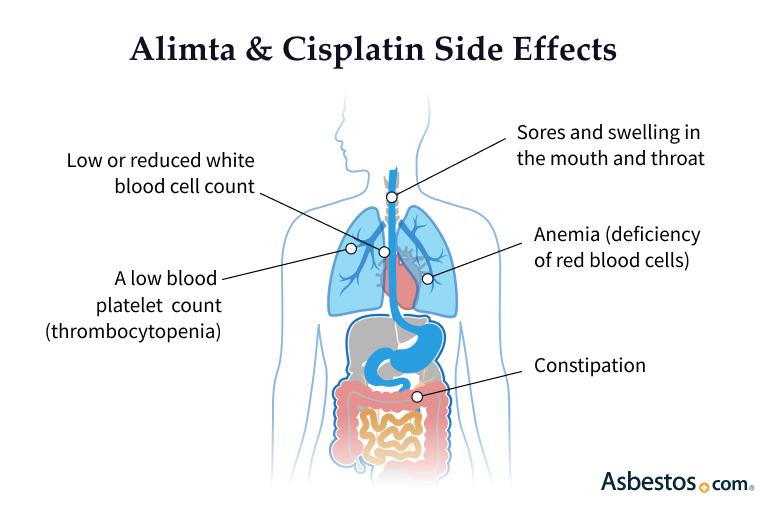 Alimta (Pemetrexed) for Mesothelioma: Benefits, Success Rate & Side Effects