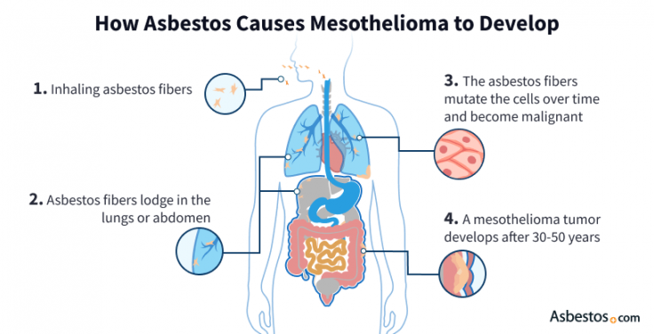 Mesothelioma Causes Asbestos Exposure Risks And Prevention