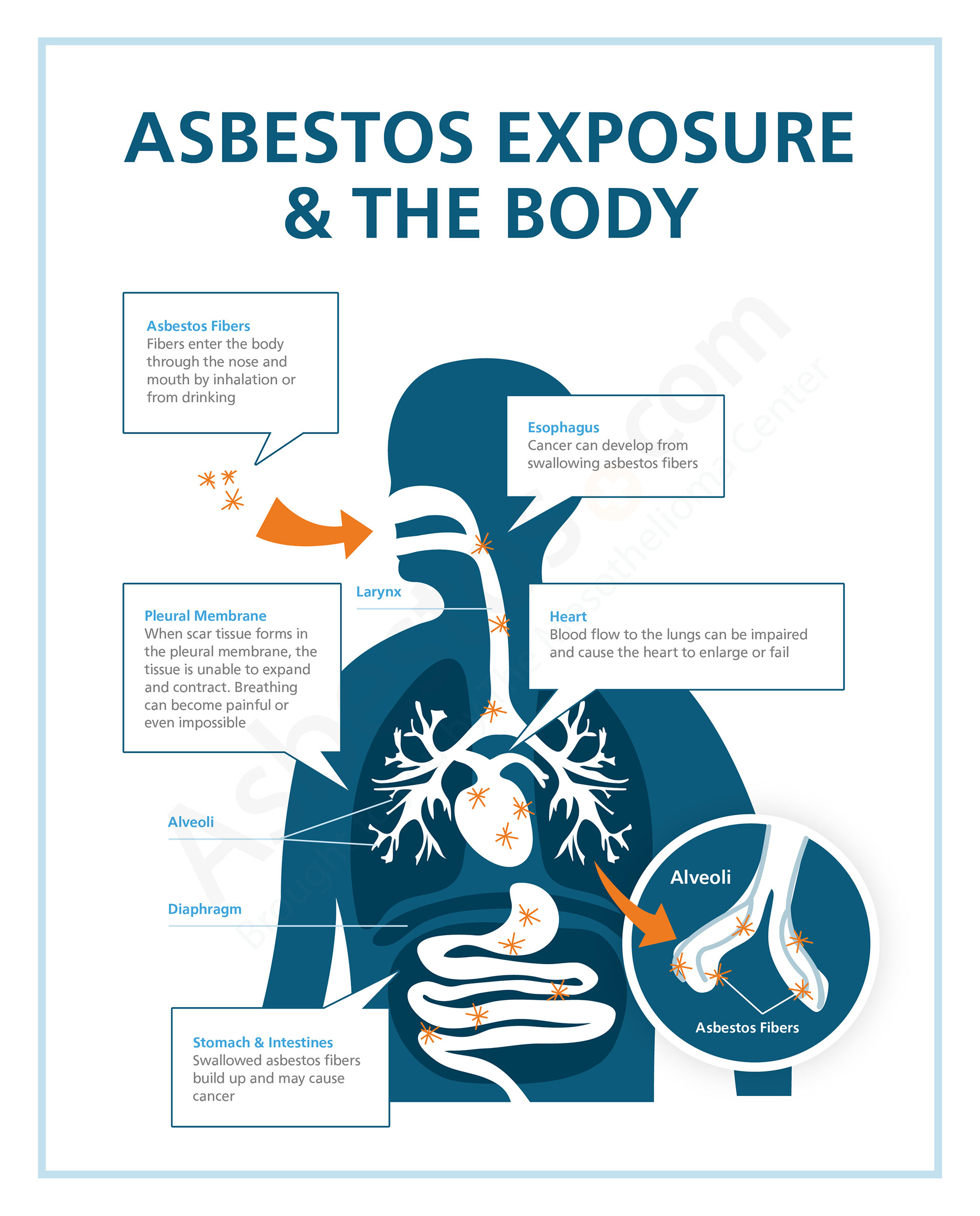 Asbestos Exposure - Risks in Occupations, Products & Jobsites Asbestos Exposure - Risks in Occupations, Products & Jobsites