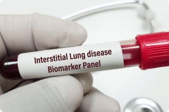 Interstitial Lung Disease: Link Between Asbestos & ILD