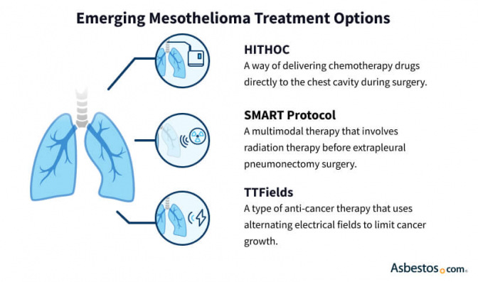 New Mesothelioma Treatments: How to Access Emerging Treatments